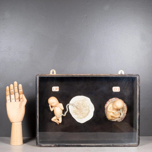 Early 19th c.Medical Teaching Device- Shadowboxed Wax Fetus Models C ...
