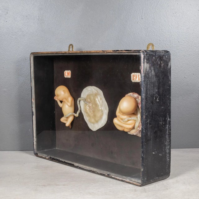 Early 19th c.Medical Teaching Device- Shadowboxed Wax Fetus Models C ...