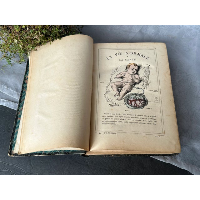 Antique Illustrated French Medical Book | Chairish
