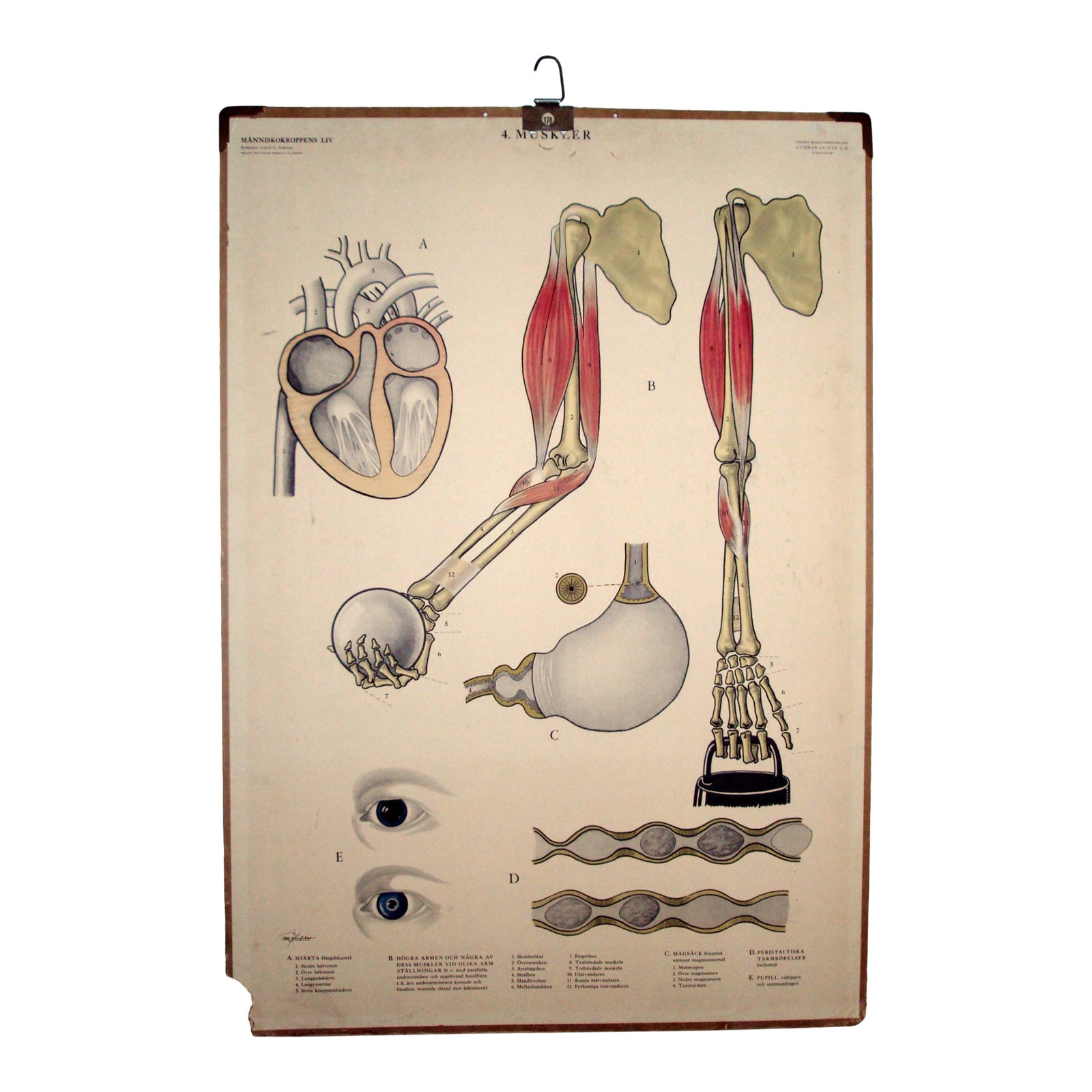 Vintage Swedish Mid-Century Medical Chart Poster | Chairish